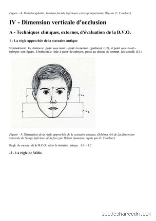 Méthode Willis pour la dimension verticale : comment ce compas mythique ...