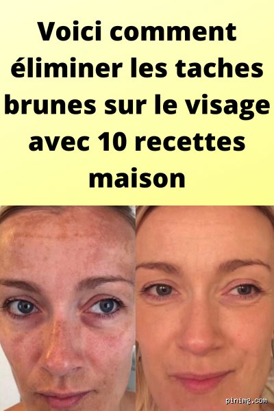 Comment enlever les taches marron sur le visage