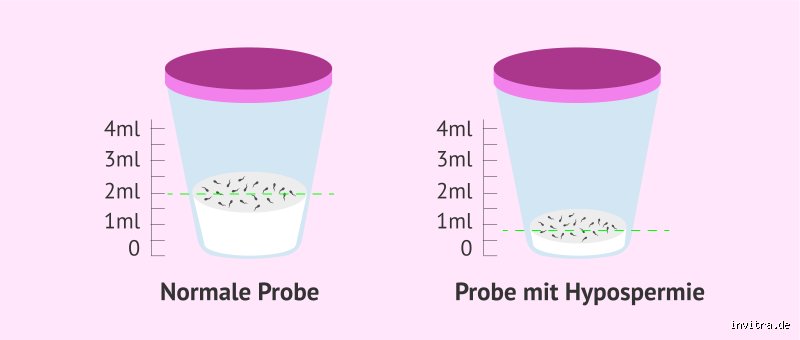 Wieviel Nachtropfen Ist Normal