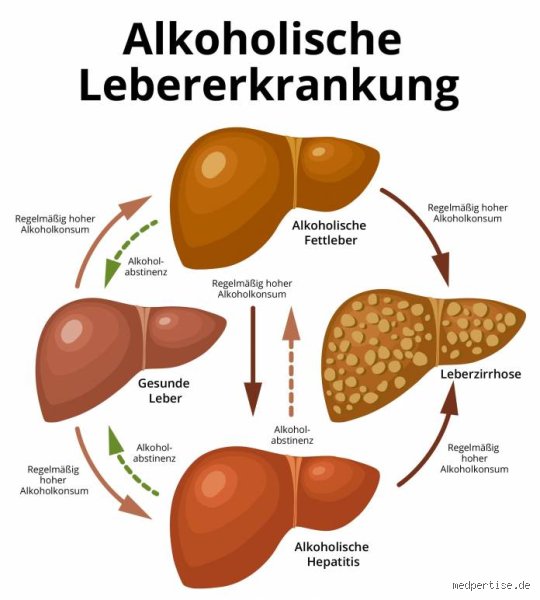 Kann die Leber sich von Alkohol erholen?