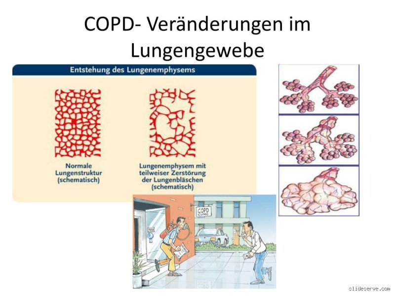 Wie huste ich richtig ab bei COPD?