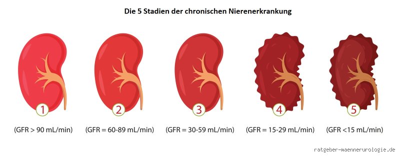 Wie Macht Sich Eine Darmentzndung Bemerkbar