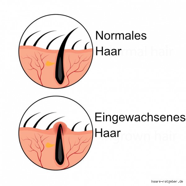 Warum Wachsen Meine Haare Nicht