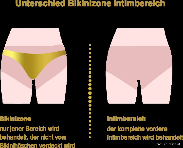 Wo Ist Die Bikinizone