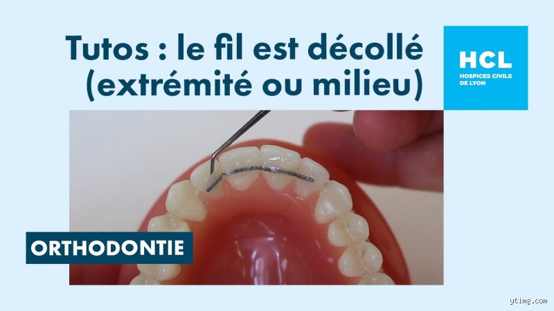 Qui peut enlever le fil de contention
