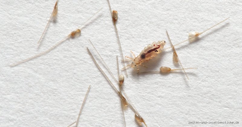 Was bedeutet Luse haben? Faktenbasierte Analyse für Betroffene