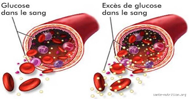 Quel aliment fait descendre le sucre dans le sang