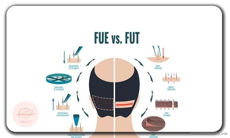 Qui fût ou qui fit