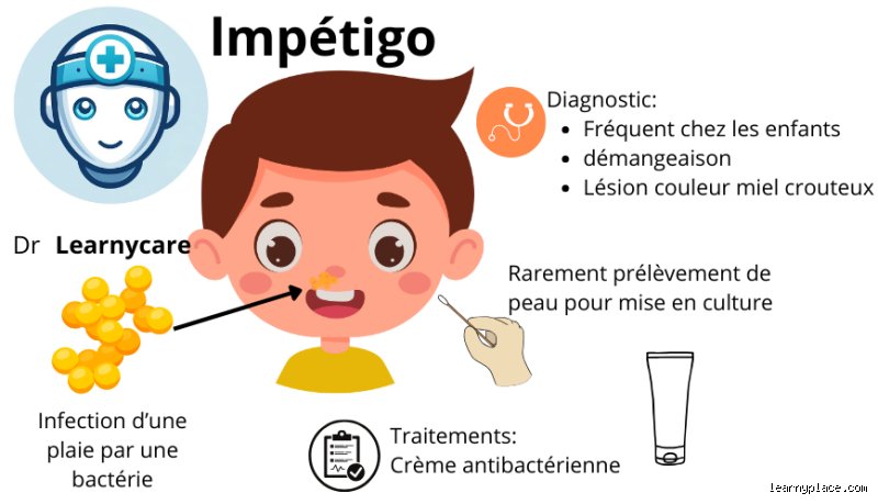 Comment on attrape l'impétigo