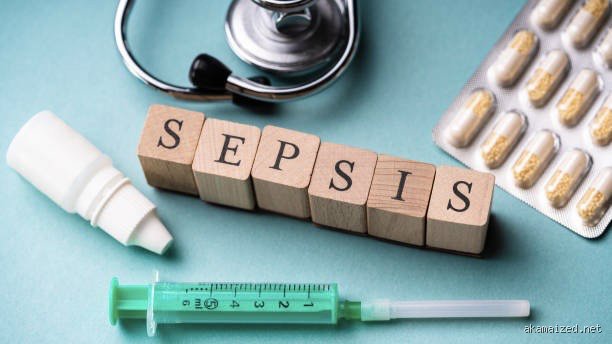 Comment arrêter une septicémie