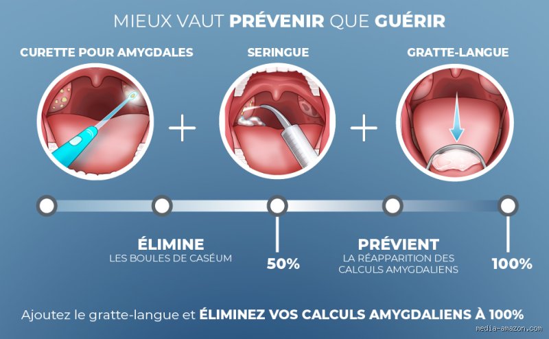 Comment faire pour ne plus avoir de caséum