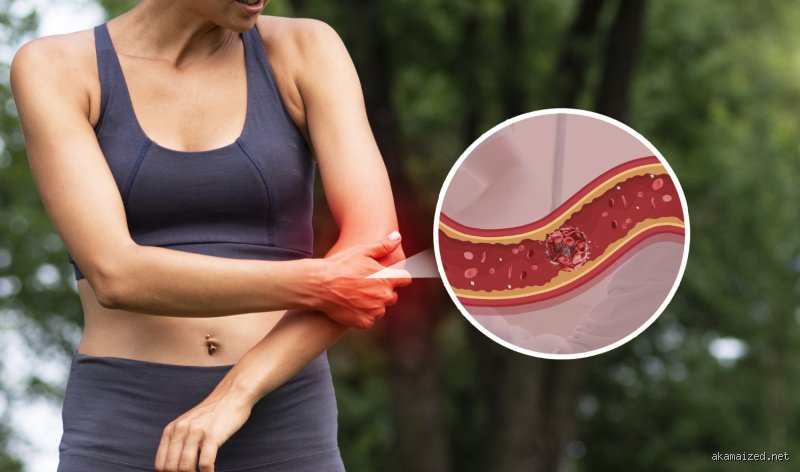 Les signes les plus courants d’inflammation : Comment les reconnaître ...